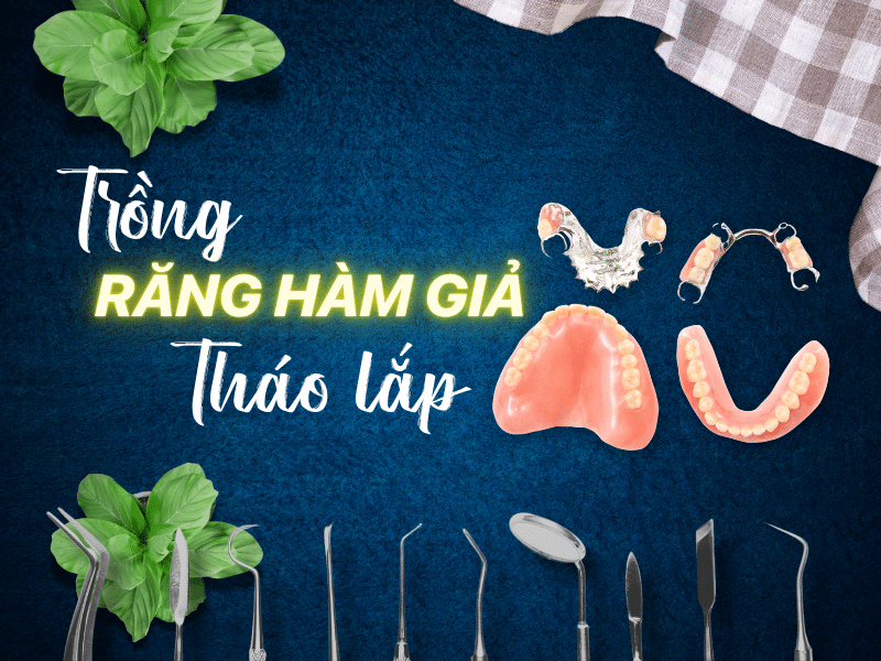 Trồng răng hàm giả tháo lắp là gì? Quy trình trồng răng hàm giả tháo lắp