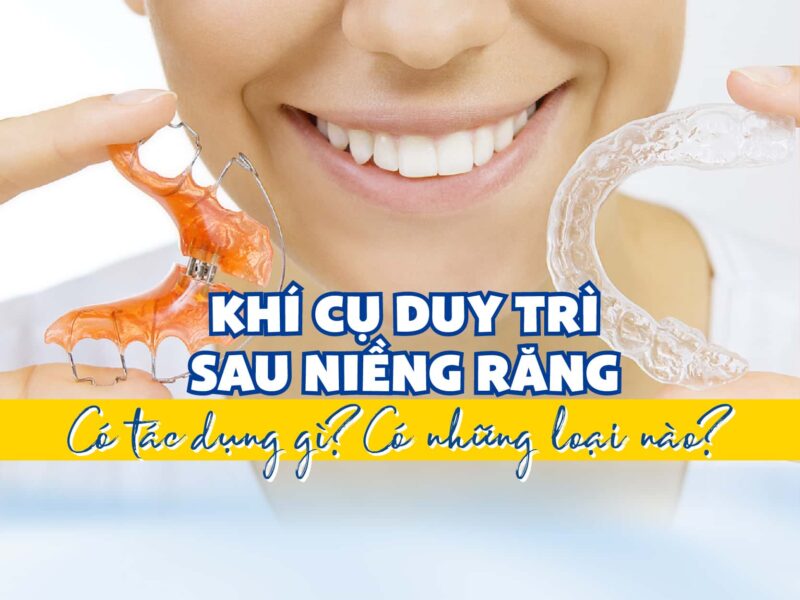 Khí cụ duy trì sau niềng răng có tác dụng gì? Có những loại nào?