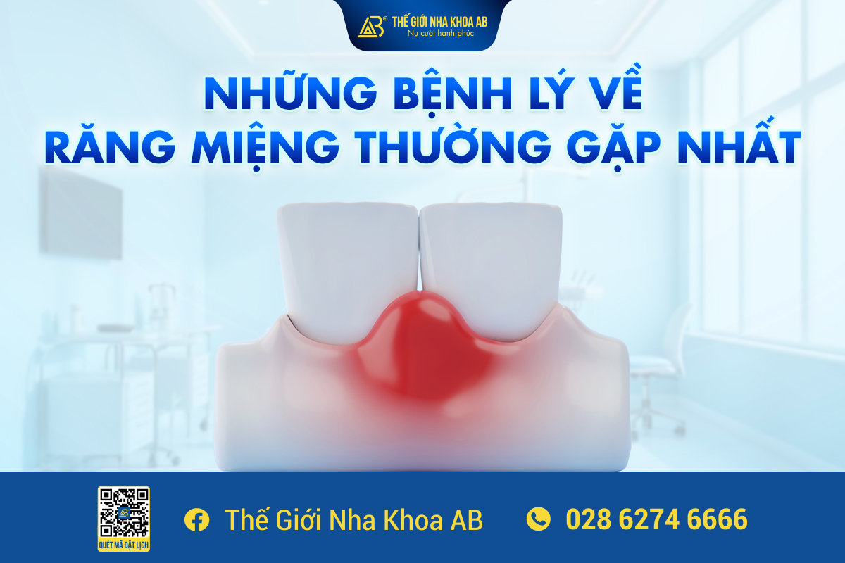 NHỮNG BỆNH LÝ VỀ RĂNG MIỆNG THƯỜNG GẶP NHẤT - Thế giới nha khoa AB